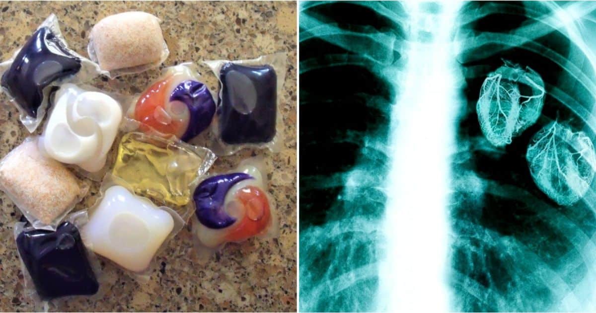 Jaké jsou výhody a nevýhody pracích kapslí? | adbz.cz